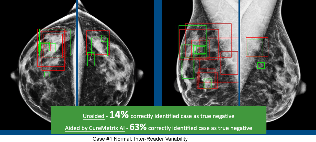AI Test Drive for Radiologists: Special RSNA Results Recap
